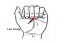 Laogong Acupoint:PC 8 Acupuncture Point Or Pericardium 8 (P8 ...